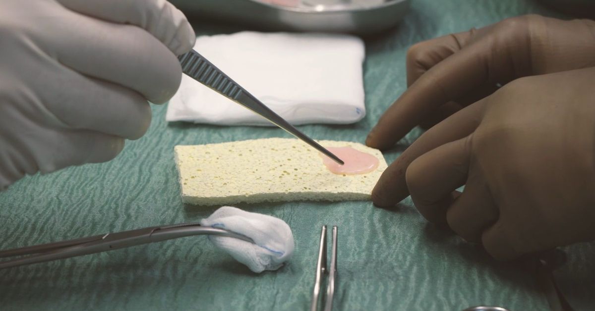 Regeneran un corazón dañado con parches musculares hechos de células madre