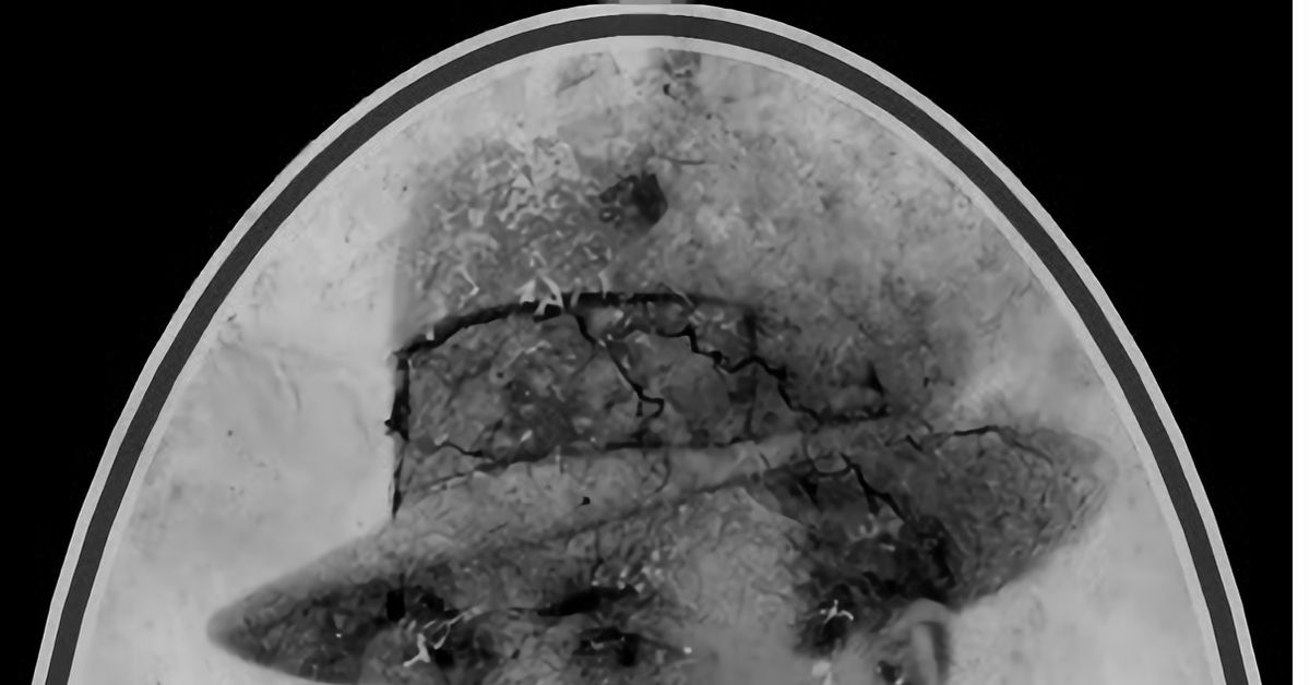 Salvador Daza recupera la memoria de José Colom Víctor