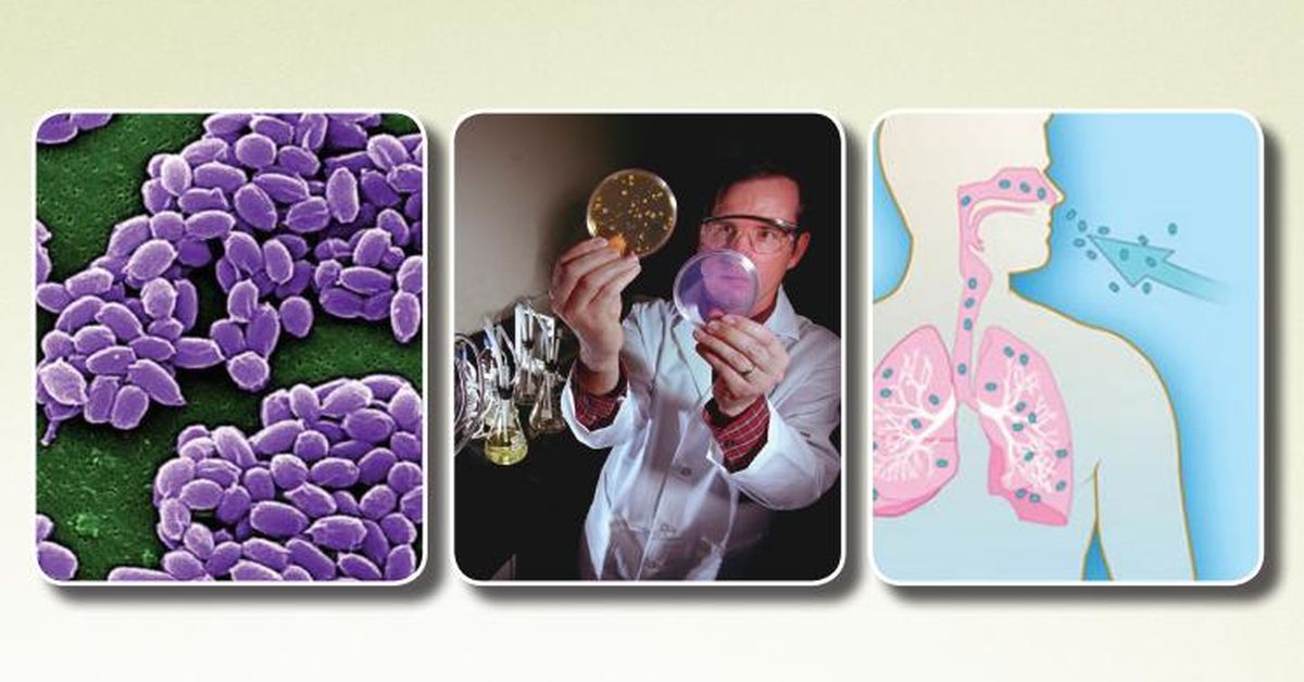 ¿Qué es el ántrax? Conoce los detalles sobre esta enfermedad infecciosa