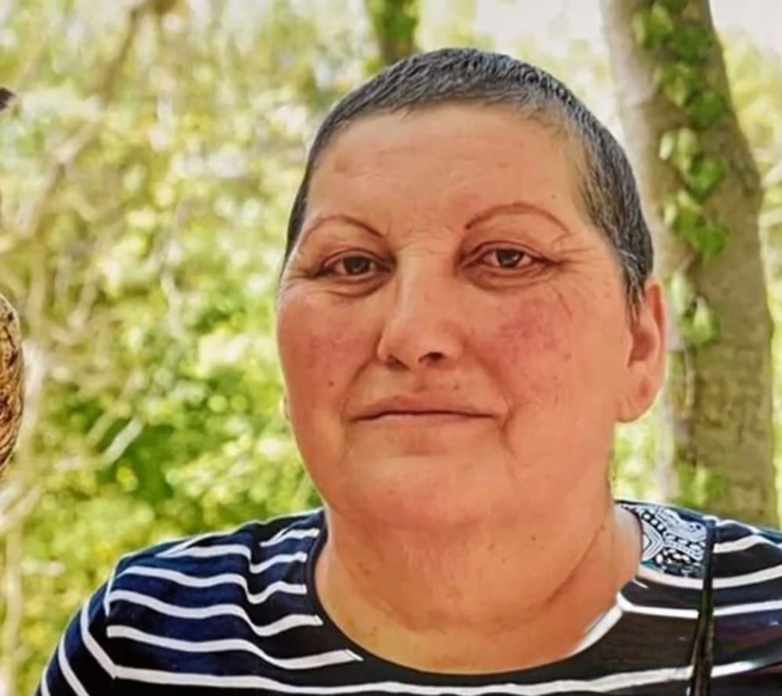 Una gaditana con diagnóstico tardío de cáncer de mama: "Durante tres años advertí a los médicos ...