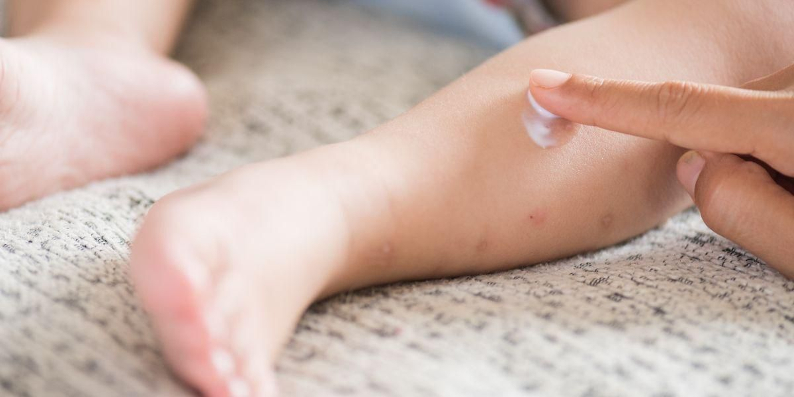 Cinco trucos caseros para acabar definitivamente con los mosquitos